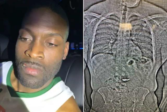 Үнэт эдлэл хулгайлаад түүнийгээ залгижээ – Delhii.mn